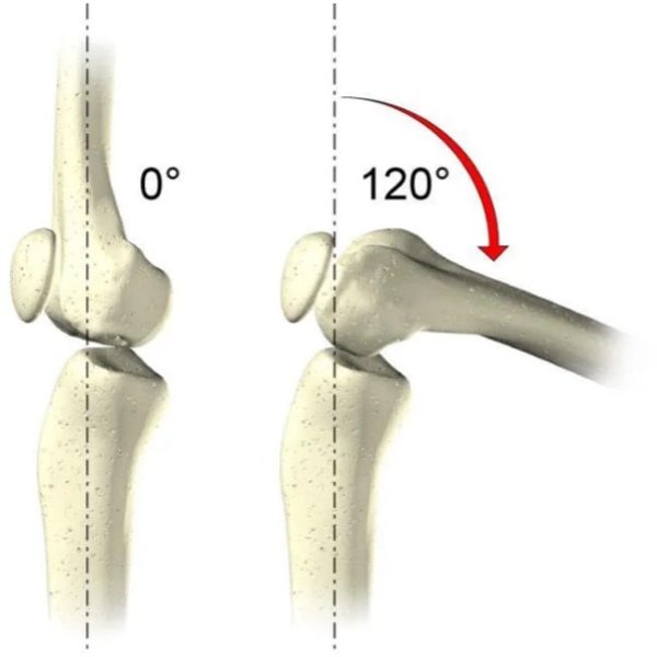 Sindrome femoro-rotulea - Centro Medico del Garda
